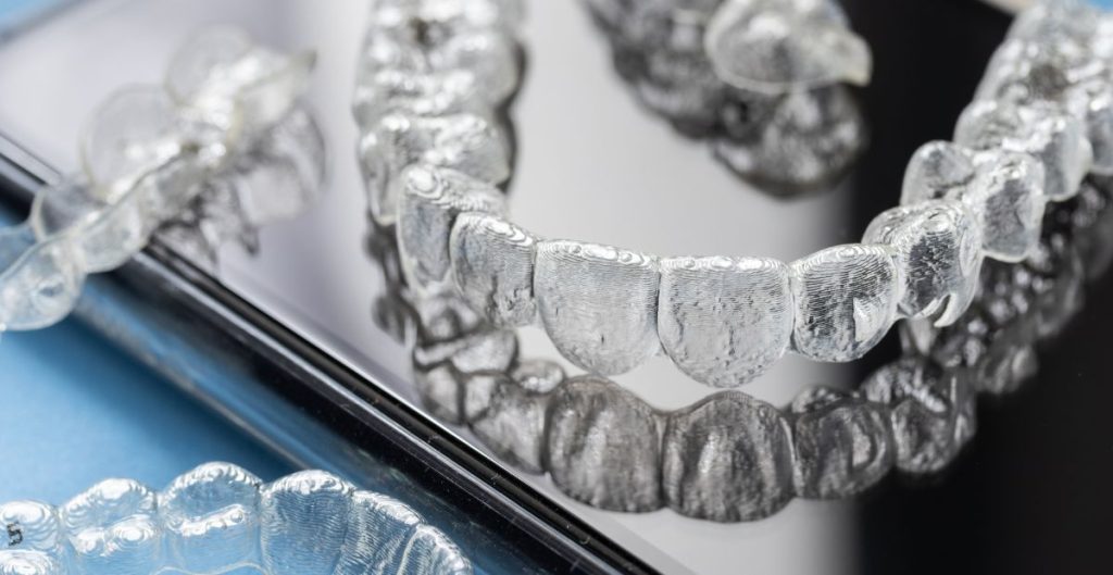 Life After Clear Aligners: Retainers and Long-Term Smile Maintenance